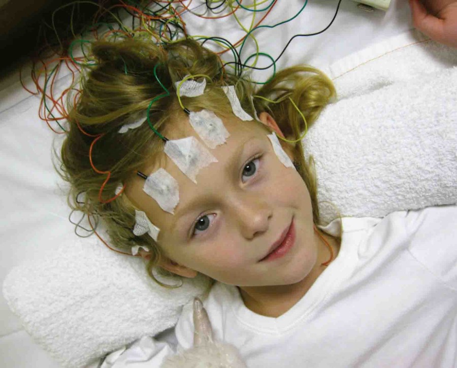 La Epilepsia en los Niños: Diagnósticos y Tratamientos - Revista Reporte MEDICO